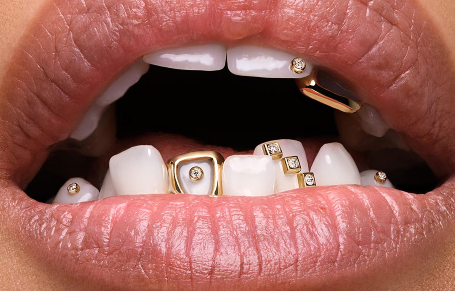 How Dental Grillz Became The Luxe Smile Statement Of 2025 - Outlook Luxe